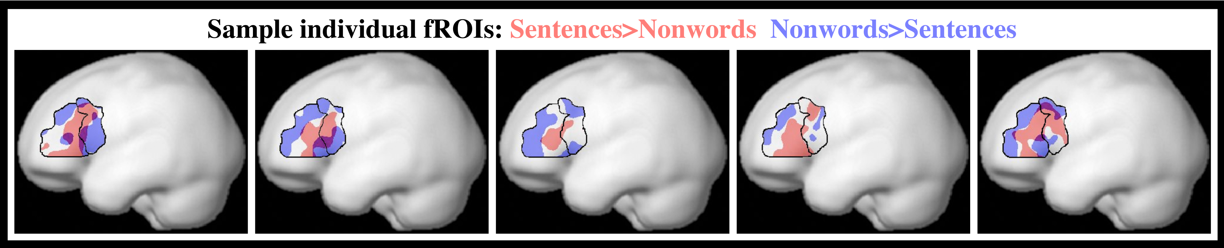 Brain's language center has multiple roles - MIT McGovern Institute