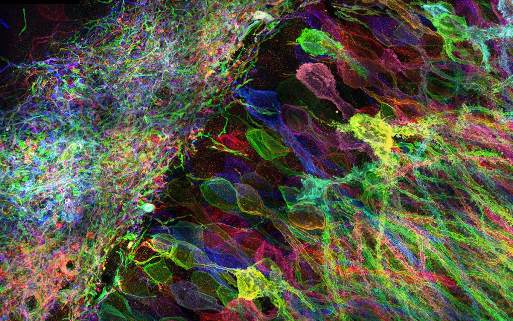 Neurotechnology - MIT McGovern Institute