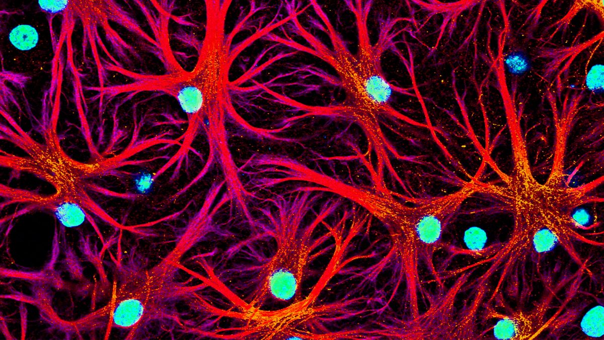 ADHD - MIT McGovern Institute