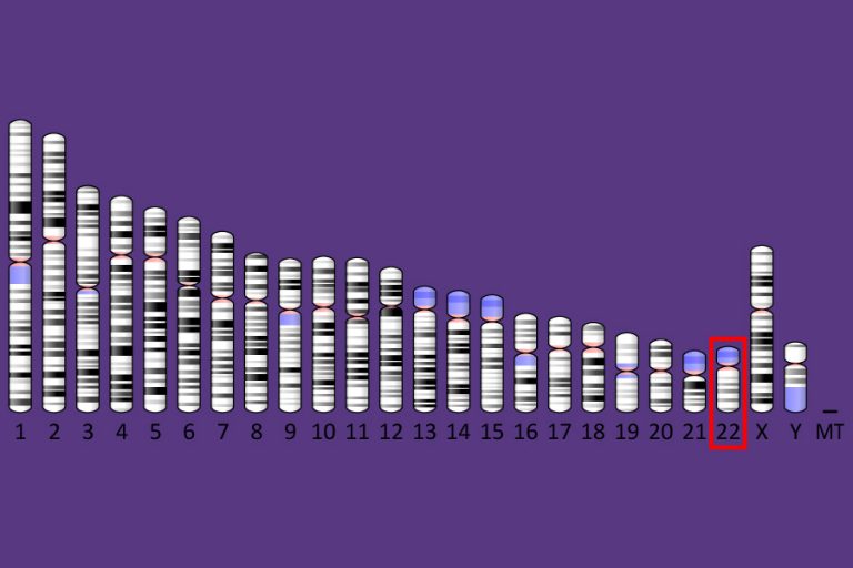 McGovern neuroscientists develop a new model for autism - MIT McGovern ...