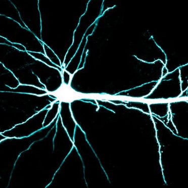 New neuron type discovered only in primate brains - MIT McGovern Institute