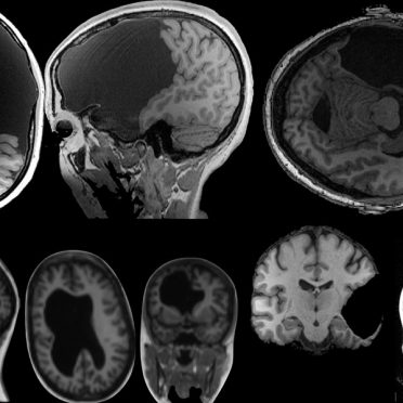 How does the brain focus? - MIT McGovern Institute