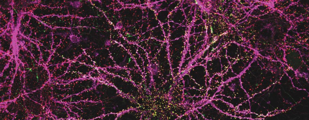 Rare Brain Disorders Nexus - MIT McGovern Institute